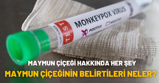 Maymun çiçeği virüsü hakkında her şey - İzmir Haberleri